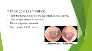 Otosclerosis Case history of a patient and management | PPTX