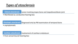 Otosclerosis | PPTX