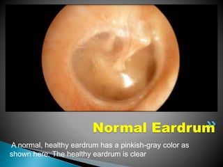 Otoscope and its uses | PPTX