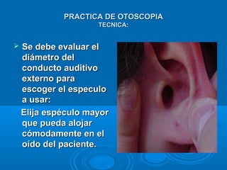 Otoscopia | PPT