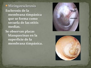 Otoscopia | PPT