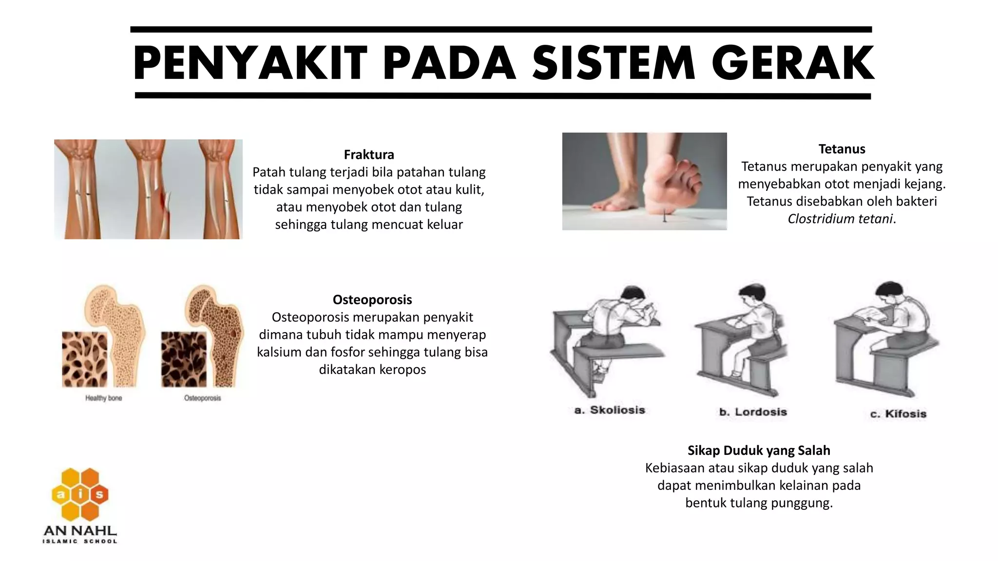 Otot dan Penyakit pada Sistem Gerak | PPTX