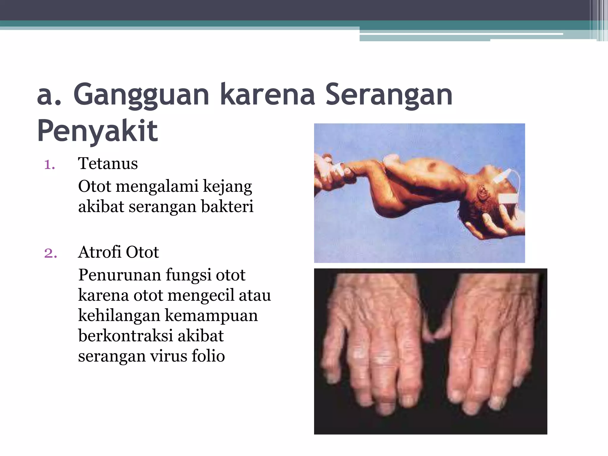 Otot manusia | PPTX