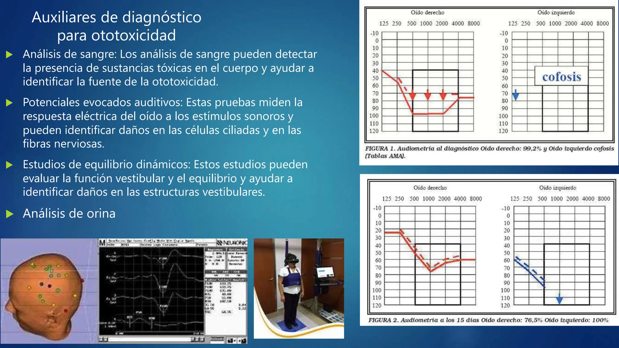 ototoxicidad y su sintomatologia aa.pptx
