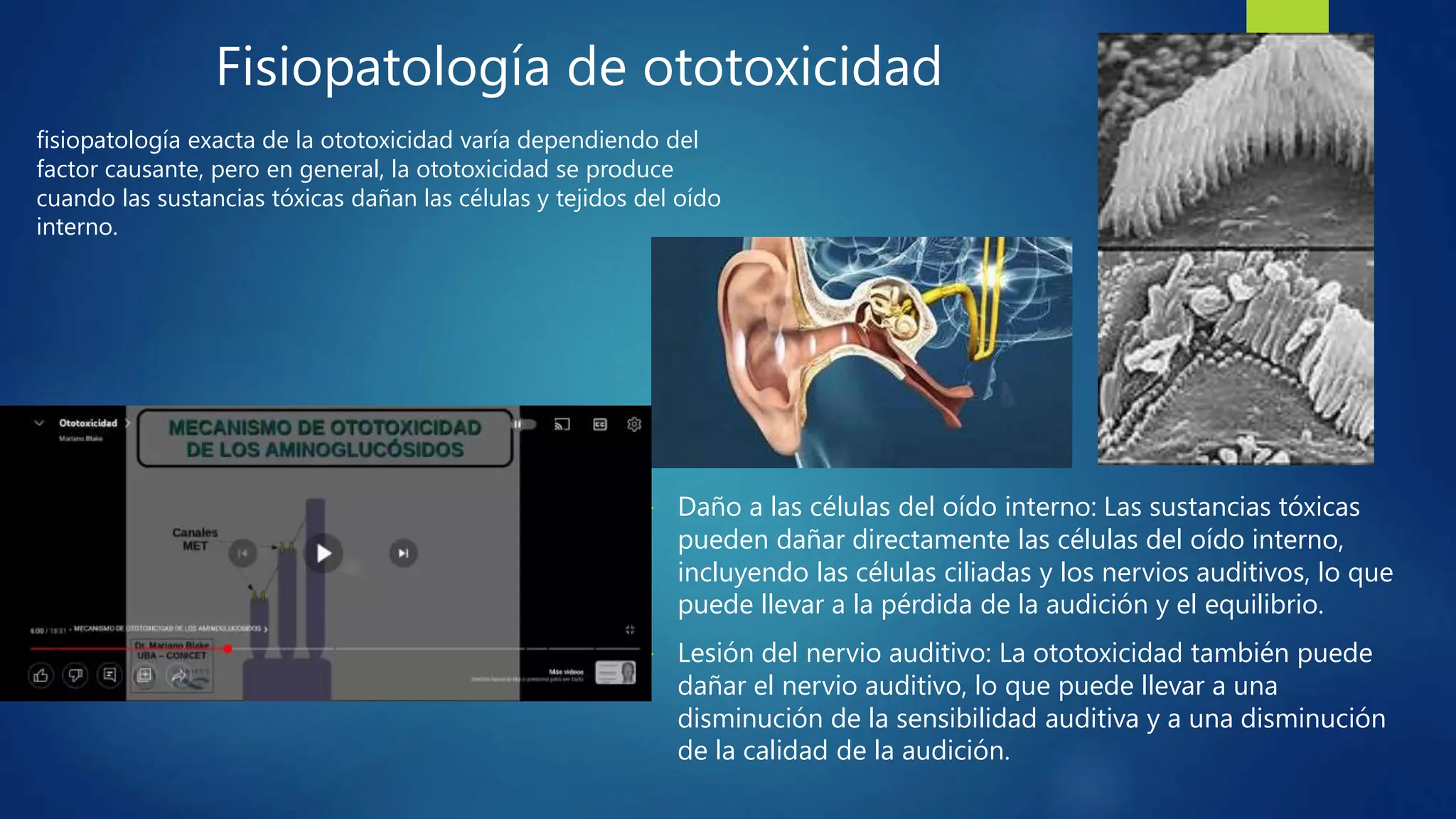 ototoxicidad y su sintomatologia aa.pptx