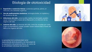 ototoxicidad y su sintomatologia aa.pptx