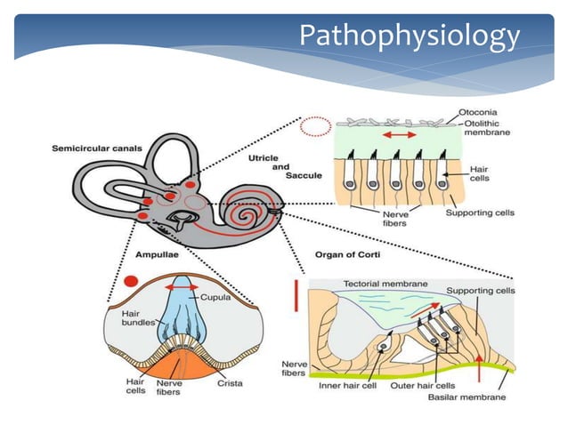Ototoxicity | PPTX | Ear, Nose and Throat Conditions | Diseases and ...