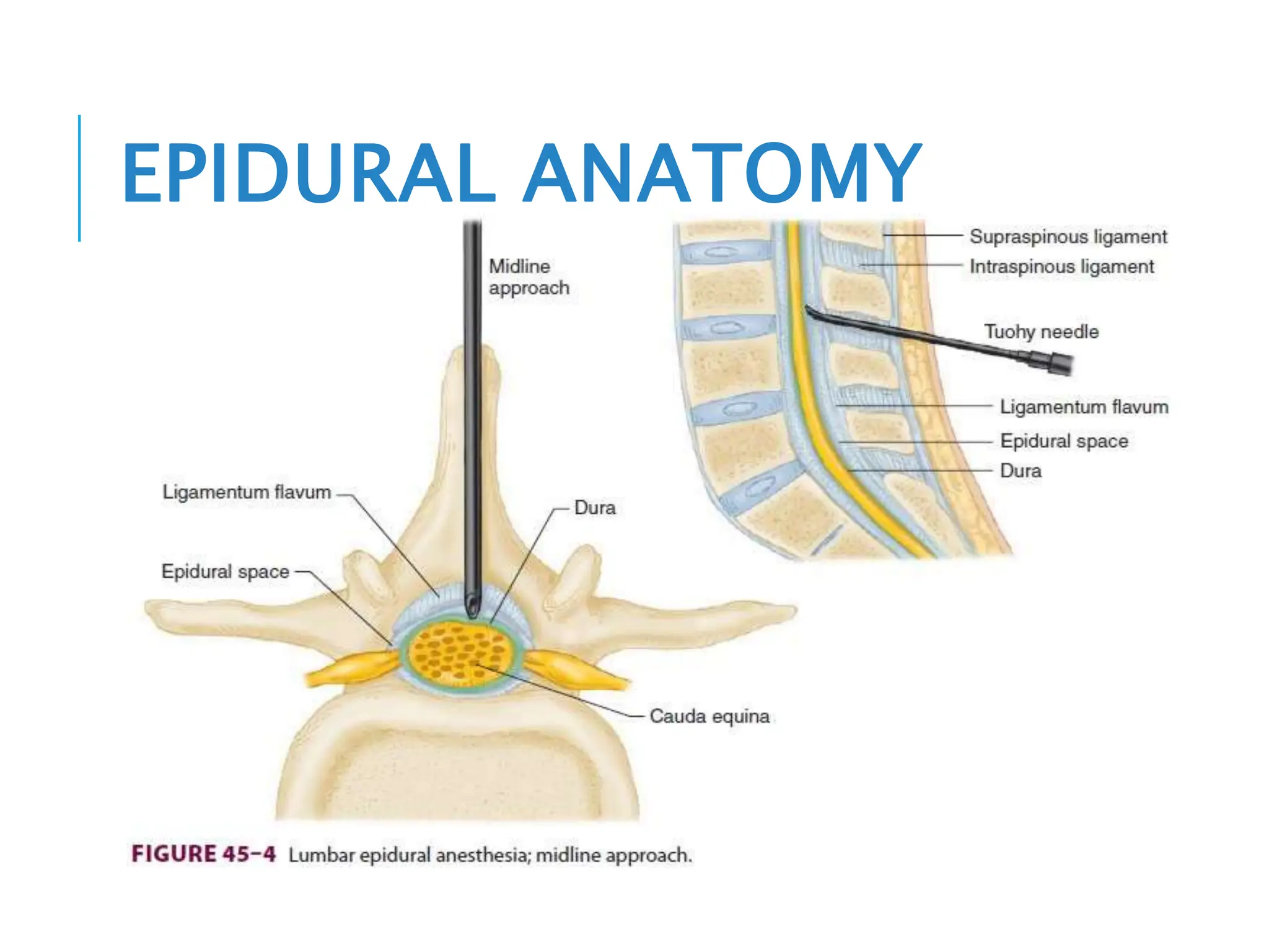 OPERATION THEATRE PREPARATION FOR EPIDURAL.pptx