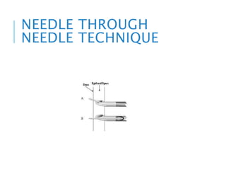 OPERATION THEATRE PREPARATION FOR EPIDURAL.pptx
