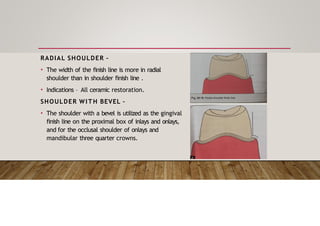 Principle of tooth preparation prosthodontics | PPTX