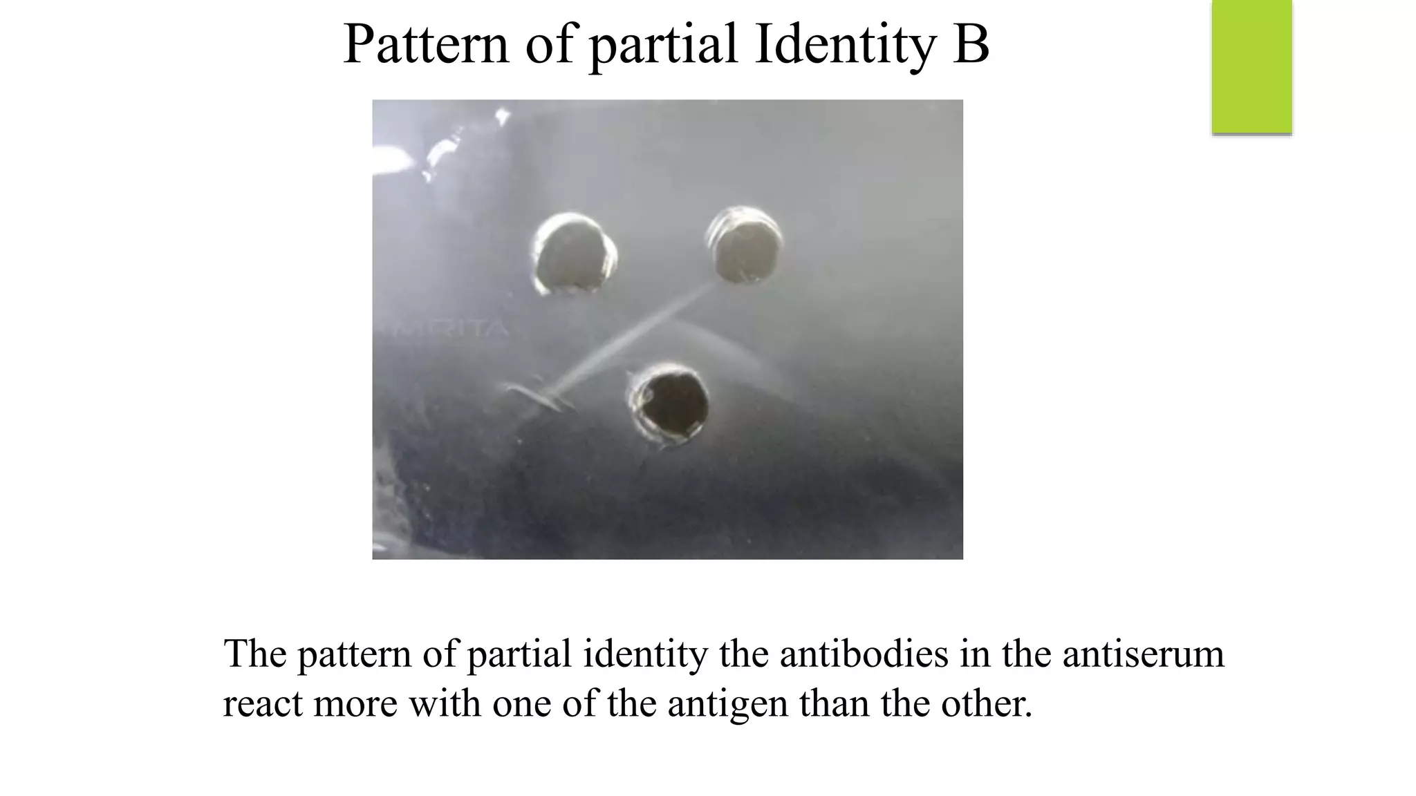 Ouchterlony double diffusion | PPTX