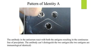 Ouchterlony double diffusion | PPTX