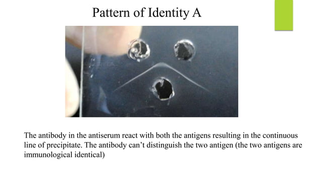 Ouchterlony double diffusion | PPTX