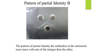 Ouchterlony double diffusion | PPTX