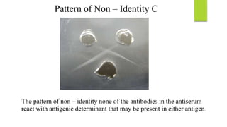 Ouchterlony double diffusion | PPTX
