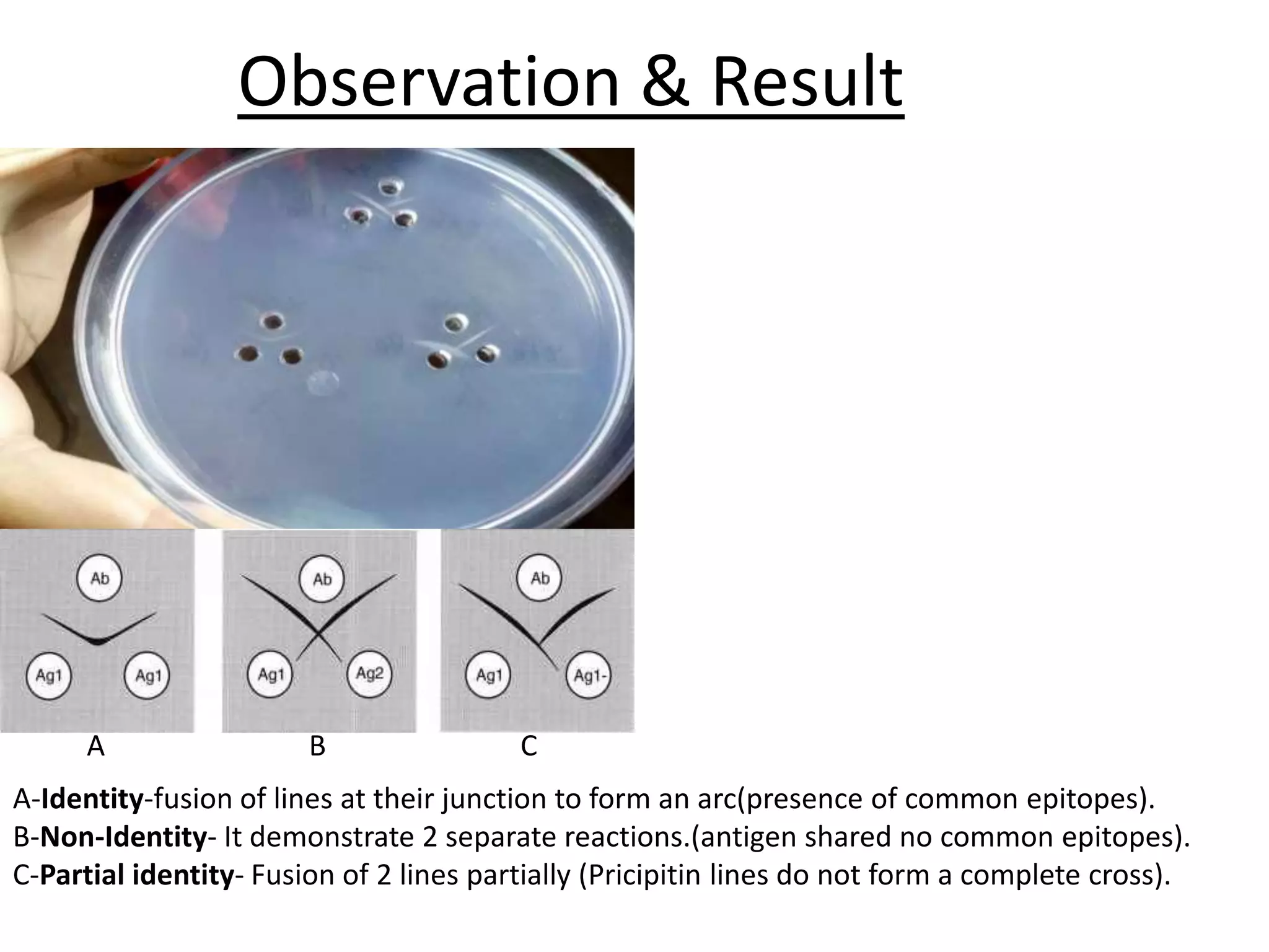 Ouchterlony double diffusion and Radial immunodifusion | PPTX