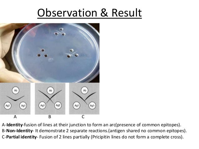 Ouchterlony double diffusion and Radial immunodifusion