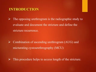OPPOSING URETHROGRAM (OUG) | PPTX