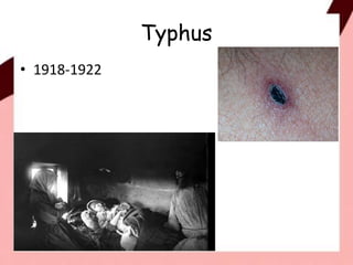 Outbreak – management | PPTX