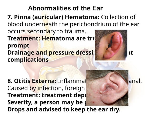 outer and middle ear functions in auditory processes, abnormalities ...