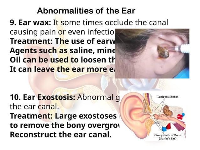 outer and middle ear functions in auditory processes, abnormalities ...