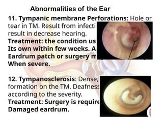 outer and middle ear functions in auditory processes, abnormalities ...