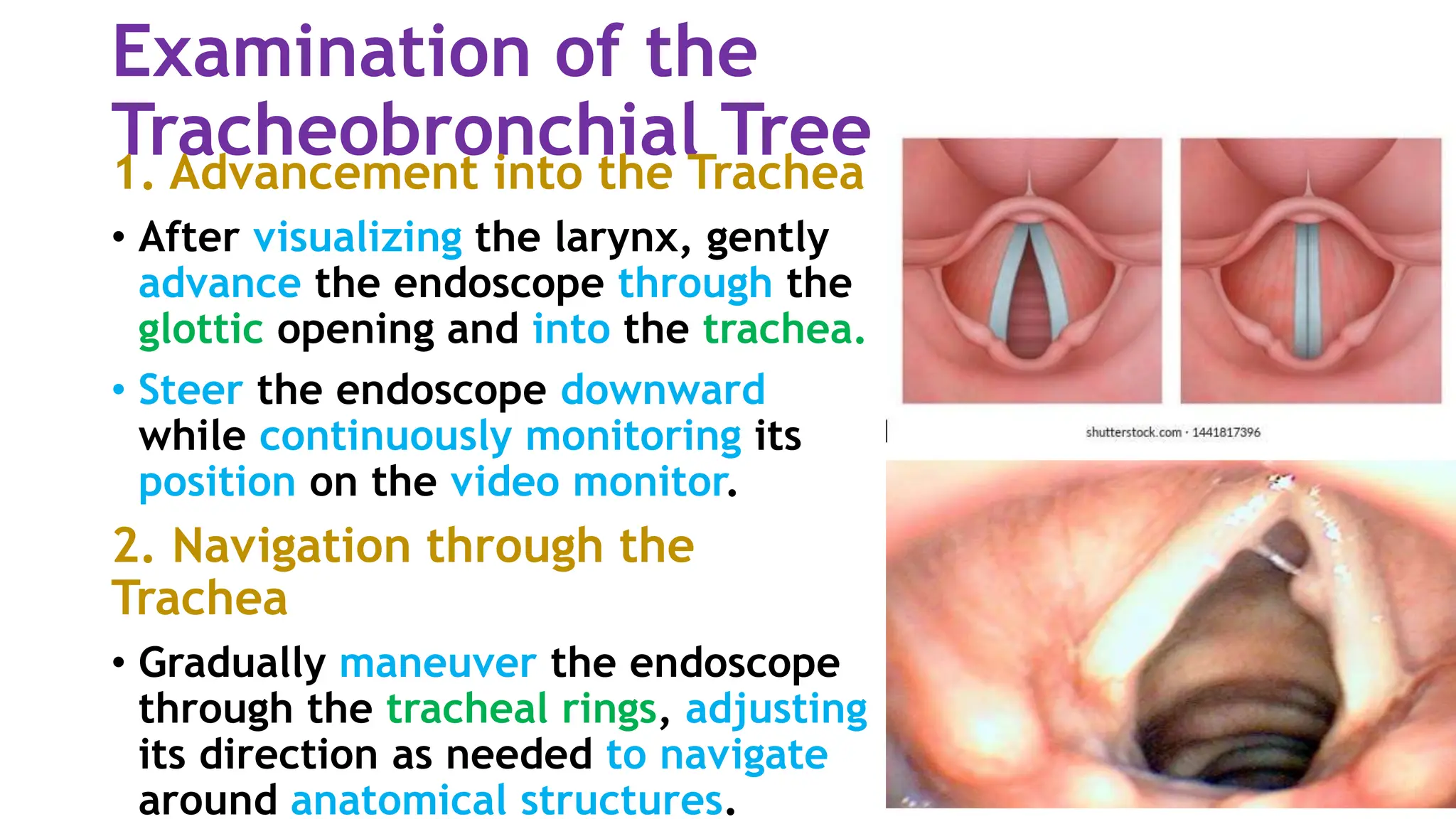 Outline the Transnasal visualization of the pharynx,larynx,.pptx