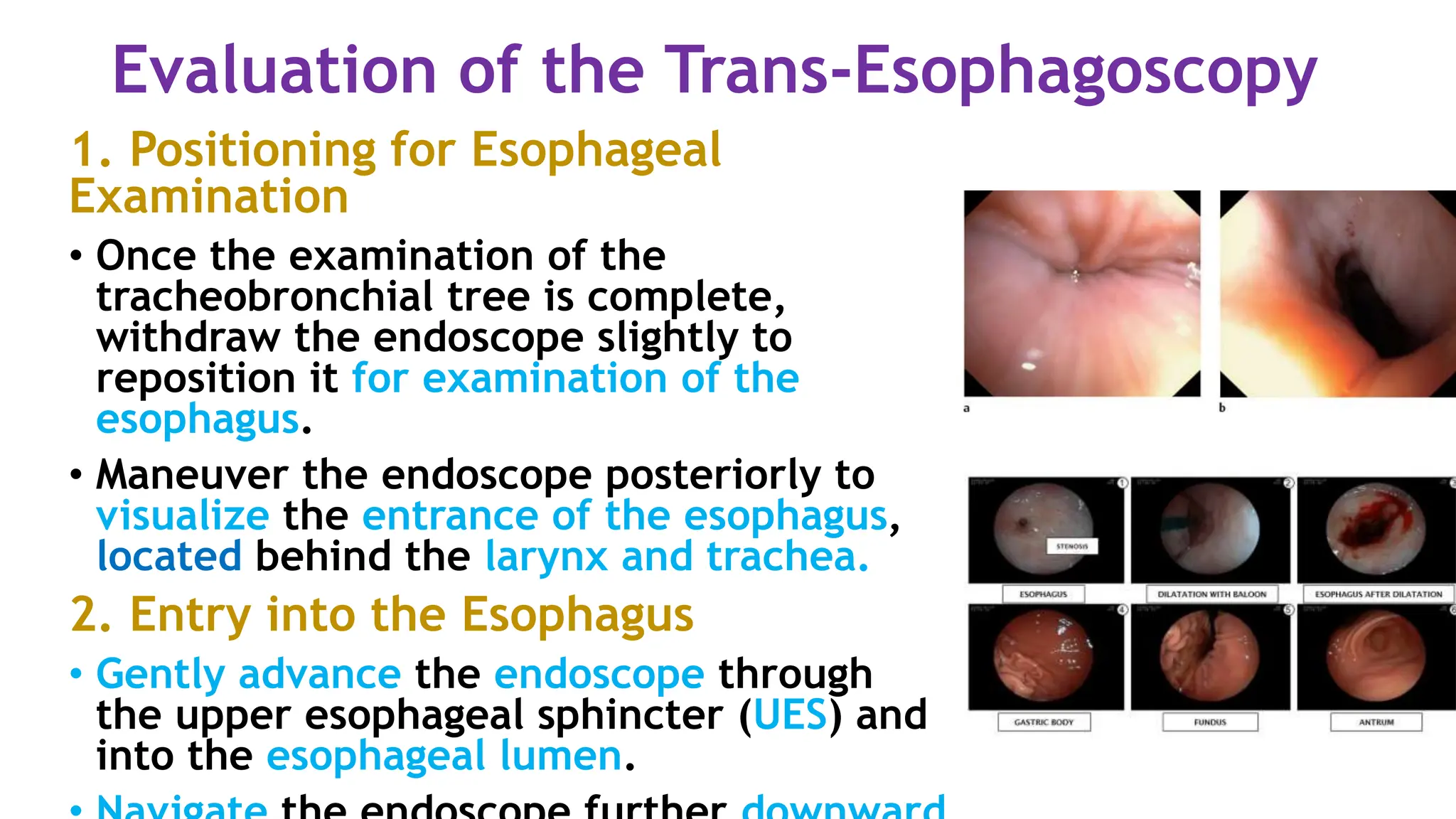 Outline the Transnasal visualization of the pharynx,larynx,.pptx