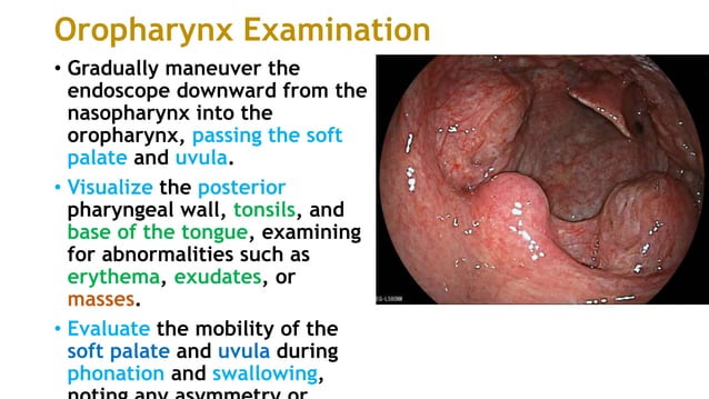 Outline the Transnasal visualization of the pharynx,larynx,.pptx | Ear ...
