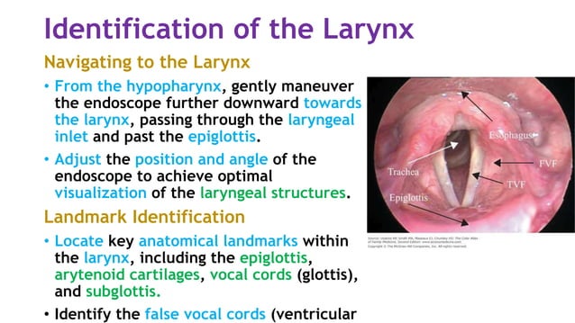 Outline the Transnasal visualization of the pharynx,larynx,.pptx | Ear ...