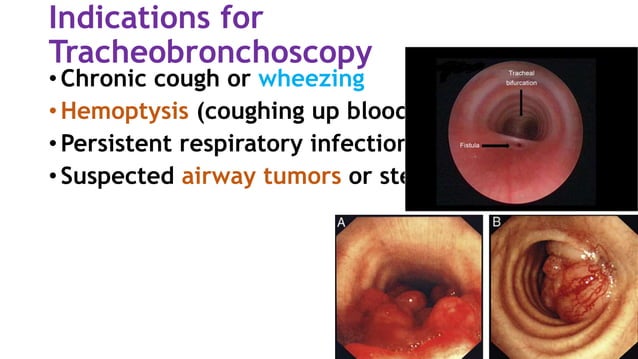 Outline the Transnasal visualization of the pharynx,larynx,.pptx | Ear ...