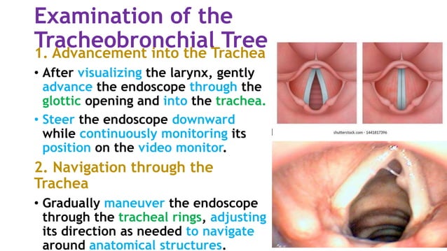 Outline the Transnasal visualization of the pharynx,larynx,.pptx | Ear ...
