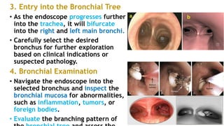 Outline the Transnasal visualization of the pharynx,larynx,.pptx