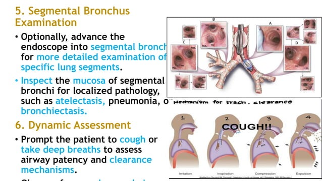 Outline the Transnasal visualization of the pharynx,larynx,.pptx | Ear ...