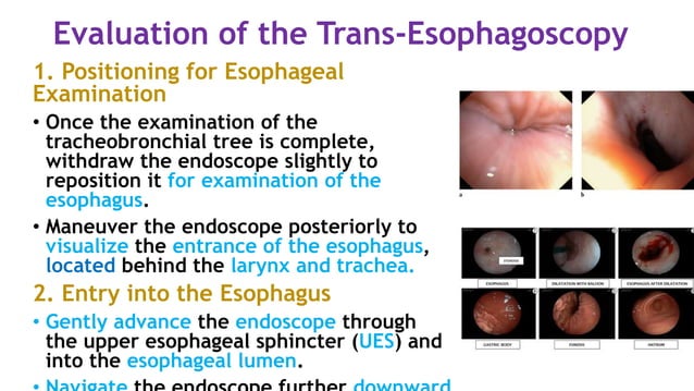 Outline the Transnasal visualization of the pharynx,larynx,.pptx | Ear ...