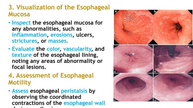 Outline the Transnasal visualization of the pharynx,larynx,.pptx | Ear ...