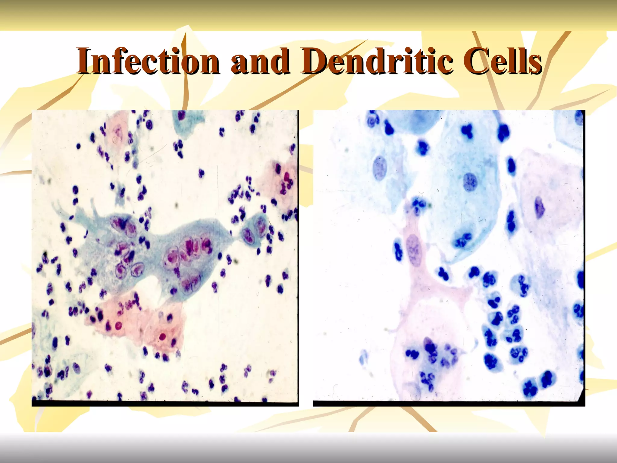 Out of africa. cytomorphology of cells on cervical smears from HIV ...