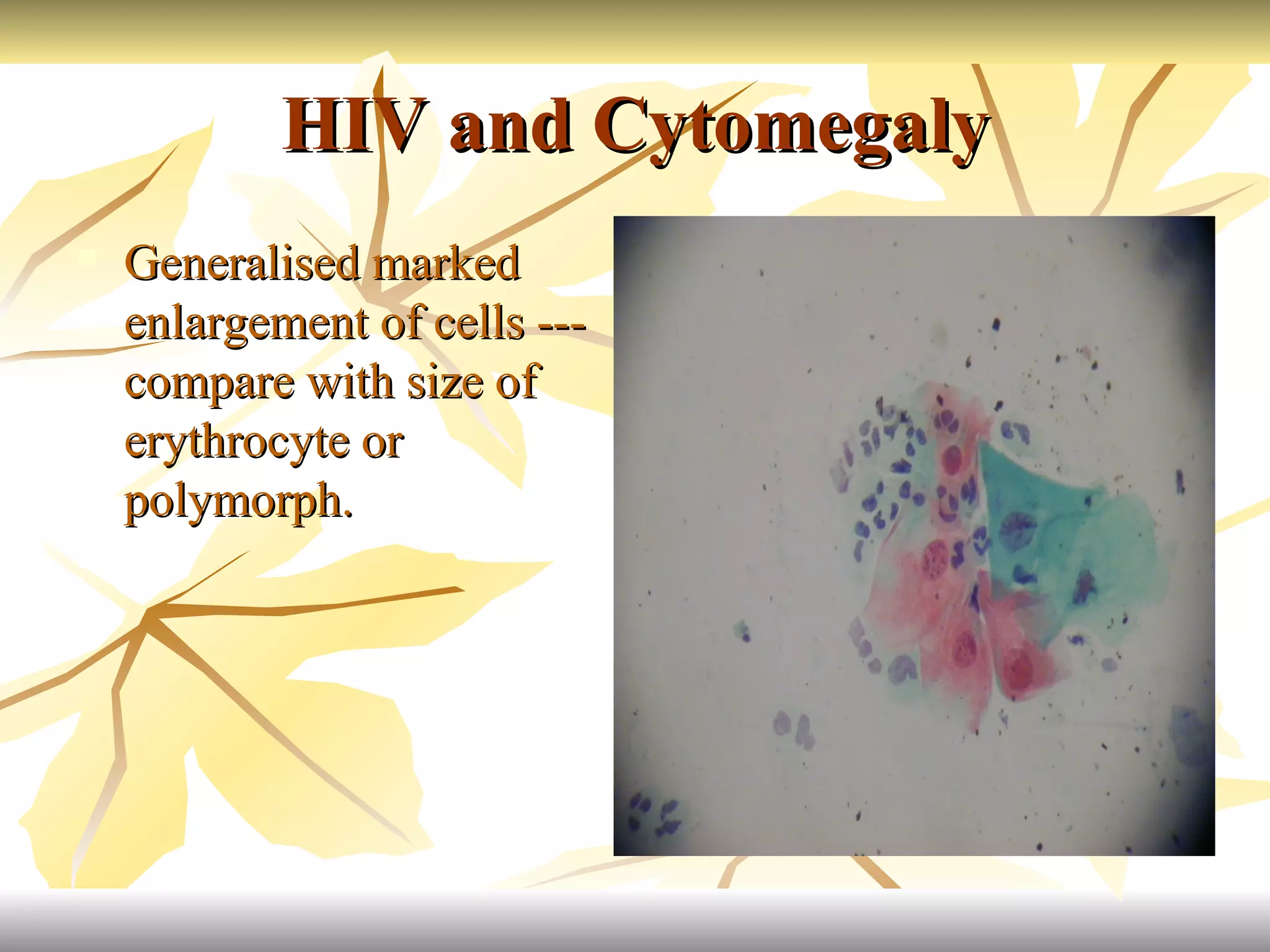 Out of africa. cytomorphology of cells on cervical smears from HIV ...