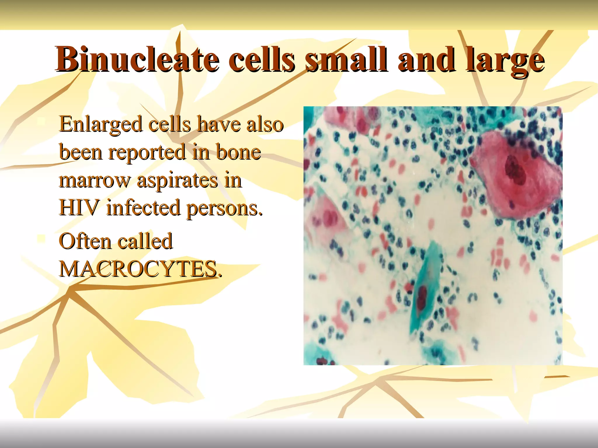 Out of africa. cytomorphology of cells on cervical smears from HIV ...