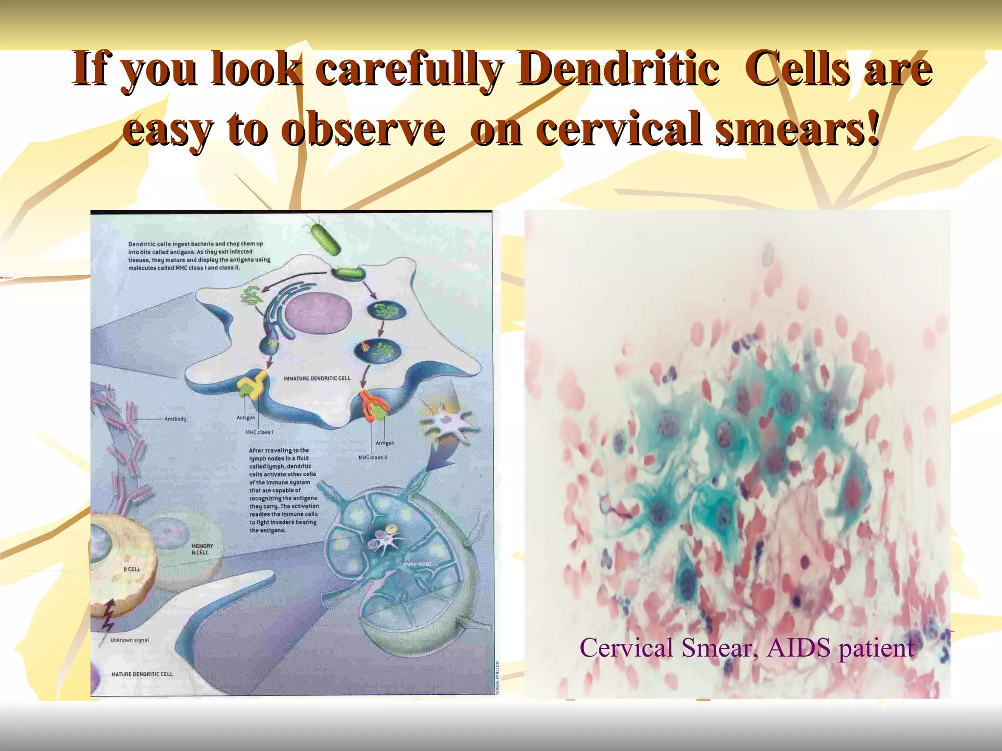 Out of africa. cytomorphology of cells on cervical smears from HIV ...