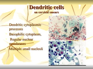 Out of africa. cytomorphology of cells on cervical smears from HIV ...