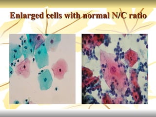 Out of africa. cytomorphology of cells on cervical smears from HIV ...