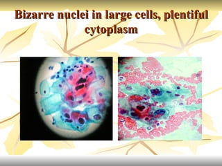 Out of africa. cytomorphology of cells on cervical smears from HIV ...