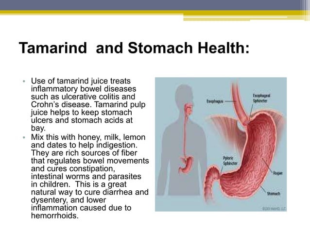 Outstanding health benefits of tamarind fruit A series of Presentation ...