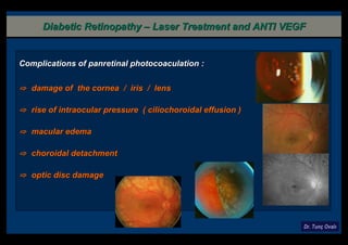 Ovali diabetic retinopathy laser treatment anti vegf | PPT