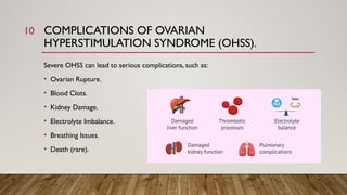 Ovarian-Hyperstimulation-Syndrome-OHSS.pptx