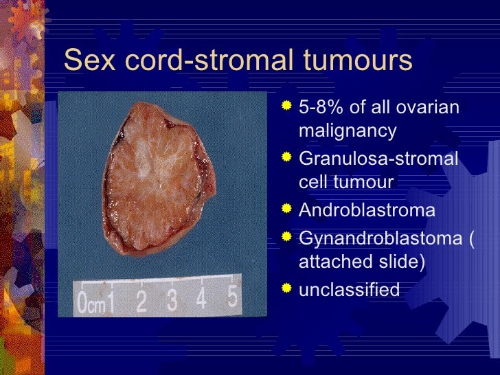 Ovarian Tumor