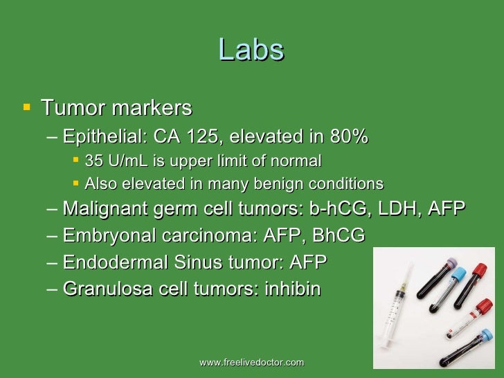 Ovariancancer