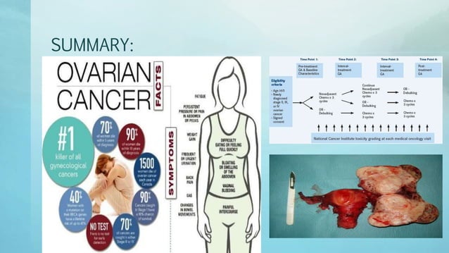 Ovarian cancer | PPT