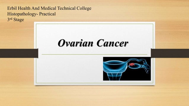 Ovarian Cancer Pptx